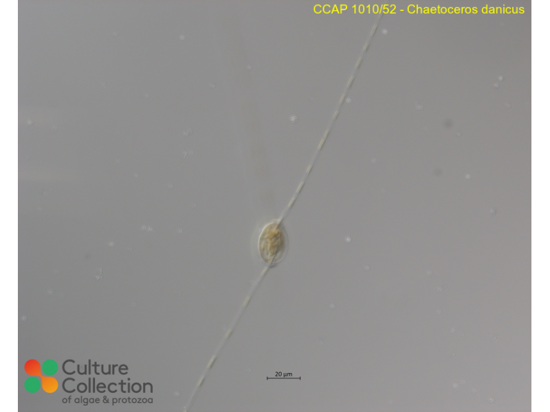 Chaetoceros rostratus