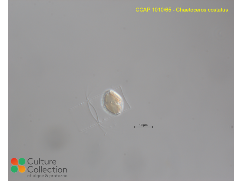 Chaetoceros costatus