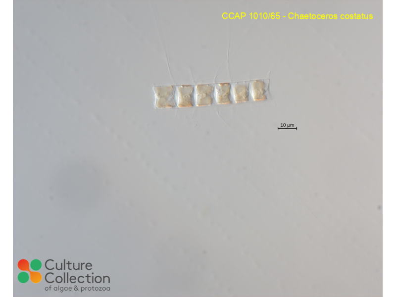 Chaetoceros costatus